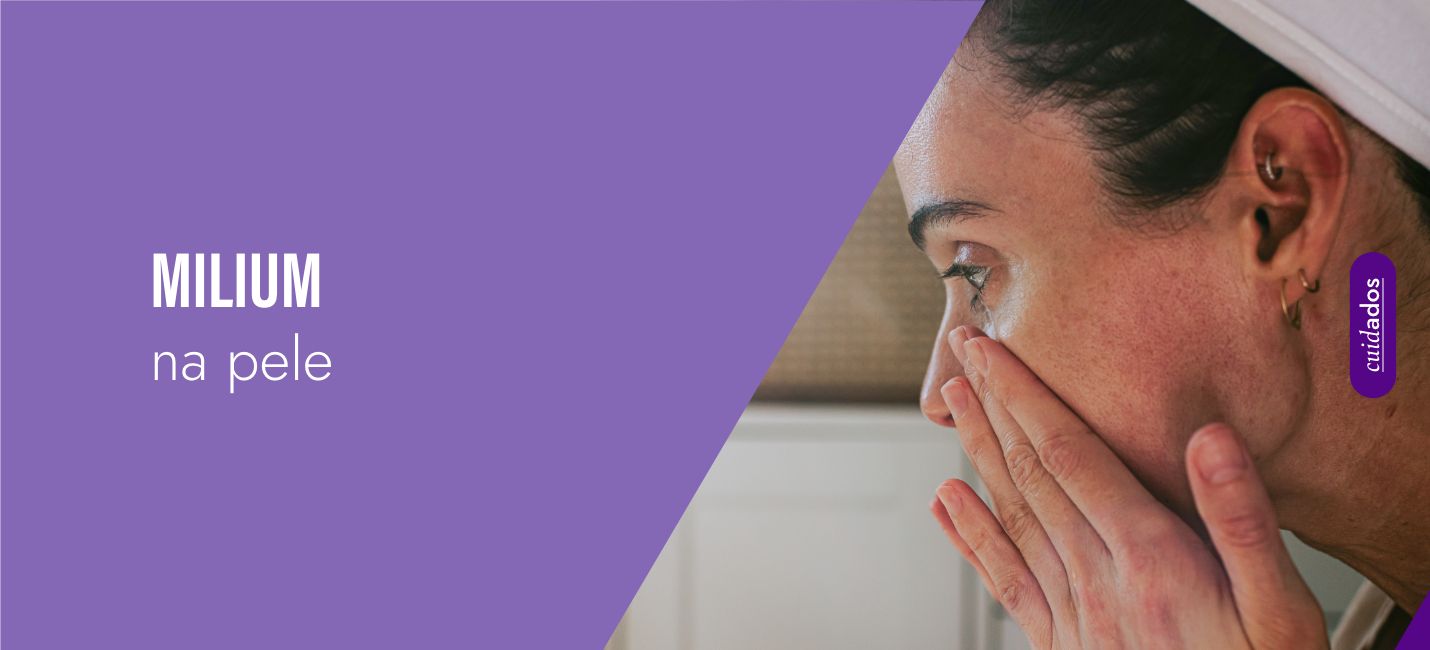 Milium na pele: o que é e como tratar? - Beleza na Web