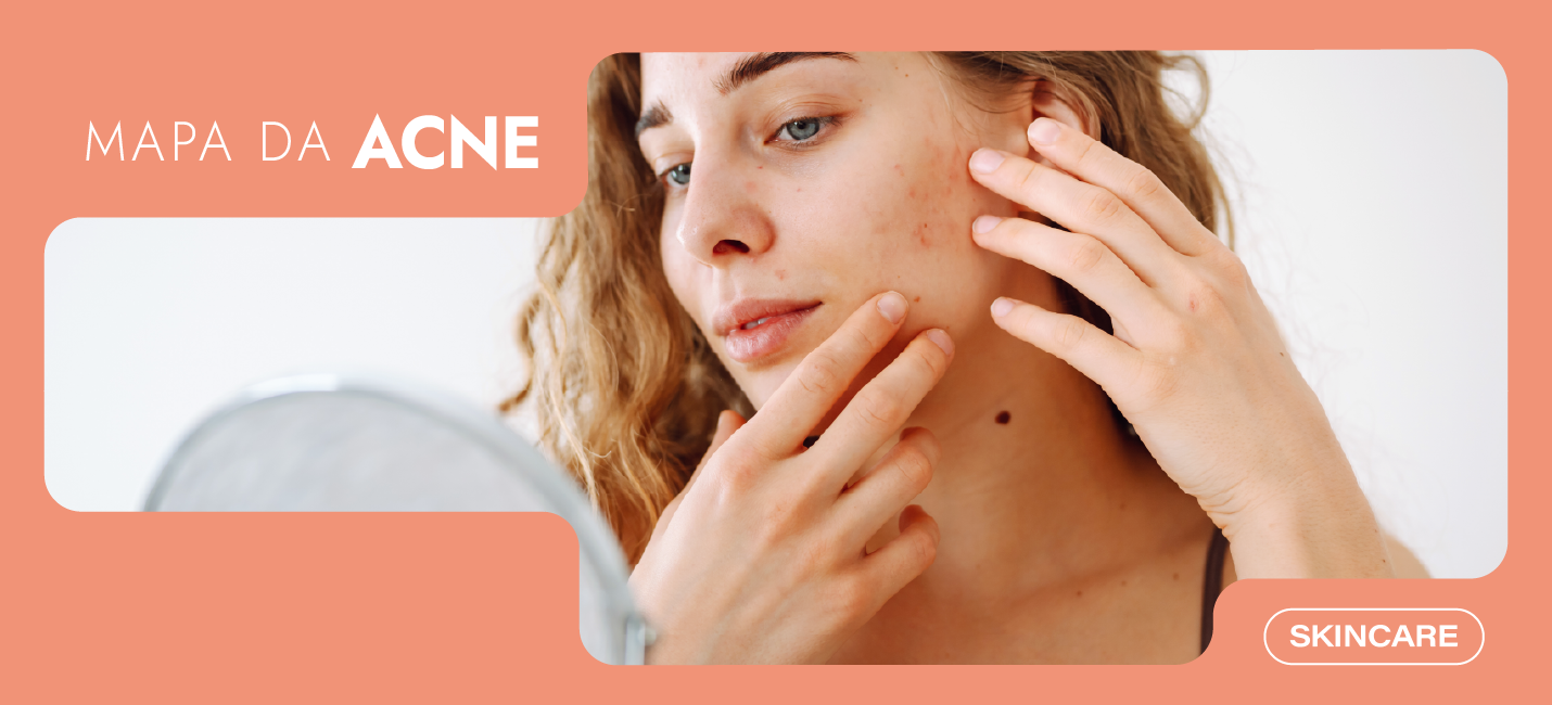 Mapa da acne: significado para cada área do rosto - Beleza na Web