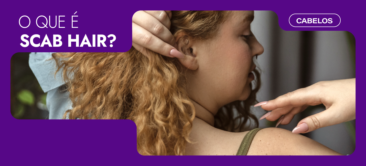 O que é "scab hair" e como tratar? - Beleza na Web